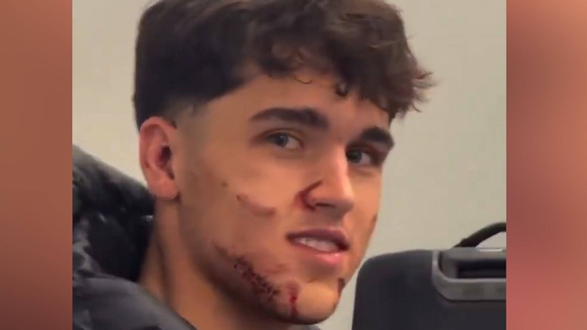 Las imágenes de la aparatosa lesión de Pau Cubarsí - AS.com